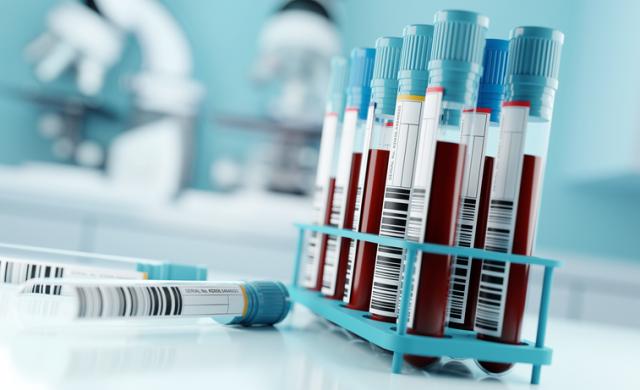 What Does My Routine Bloodwork Mean? | Catholic Health Long Island