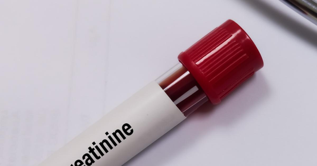 What Do High Creatinine Levels Mean? | Catholic Health Long Island